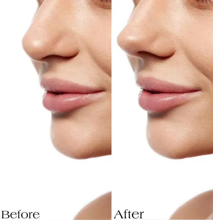 6Pc/Set Nose Shaping Insert – DEANITY